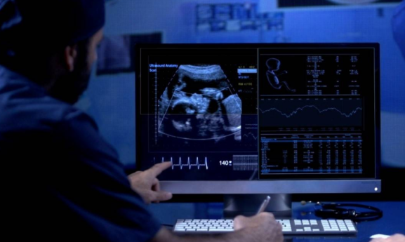 Nuevo dispositivo para realizar biopsias guiadas en tiempo real ...